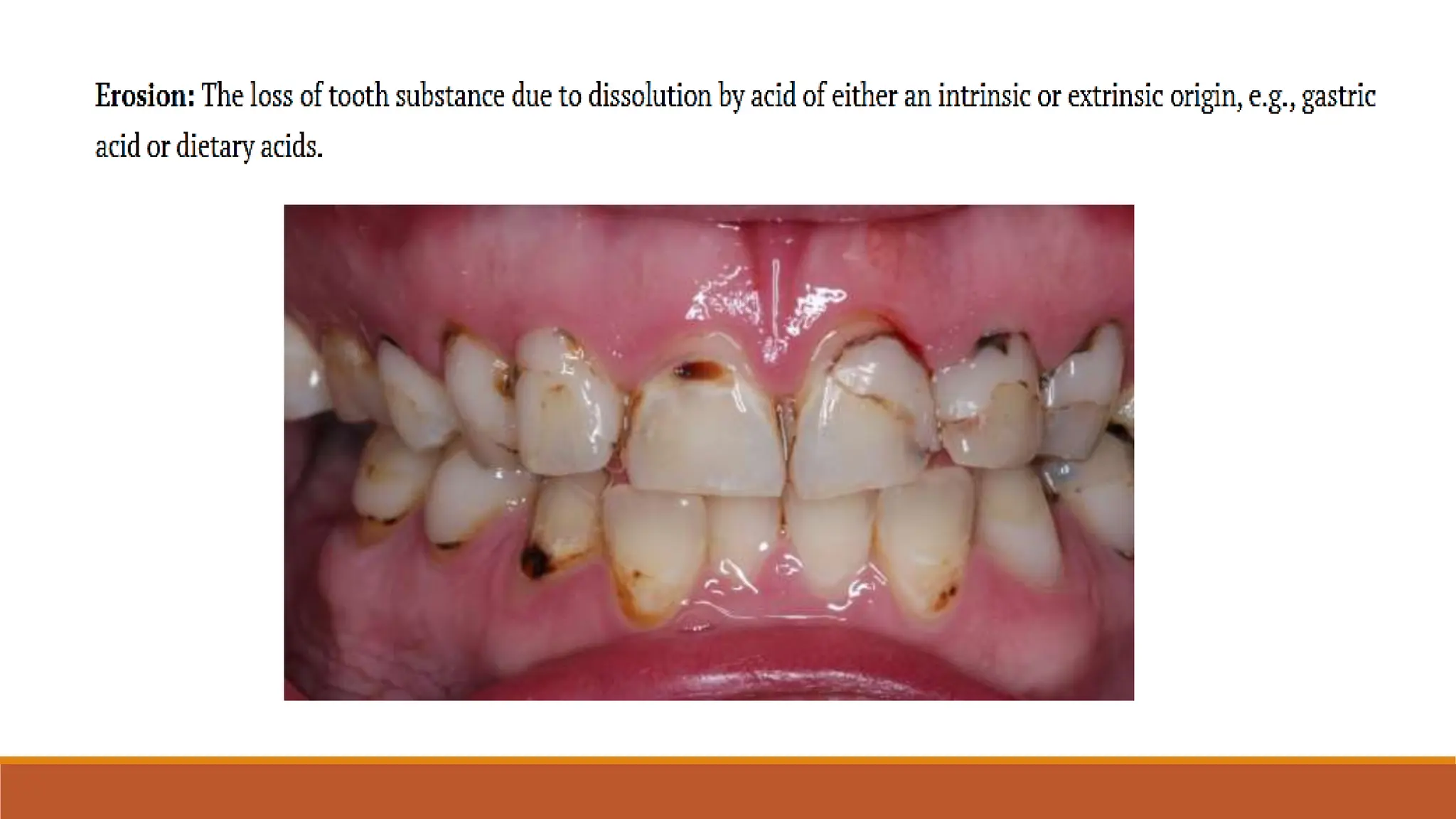 intraoral and extraoral examination.pptx