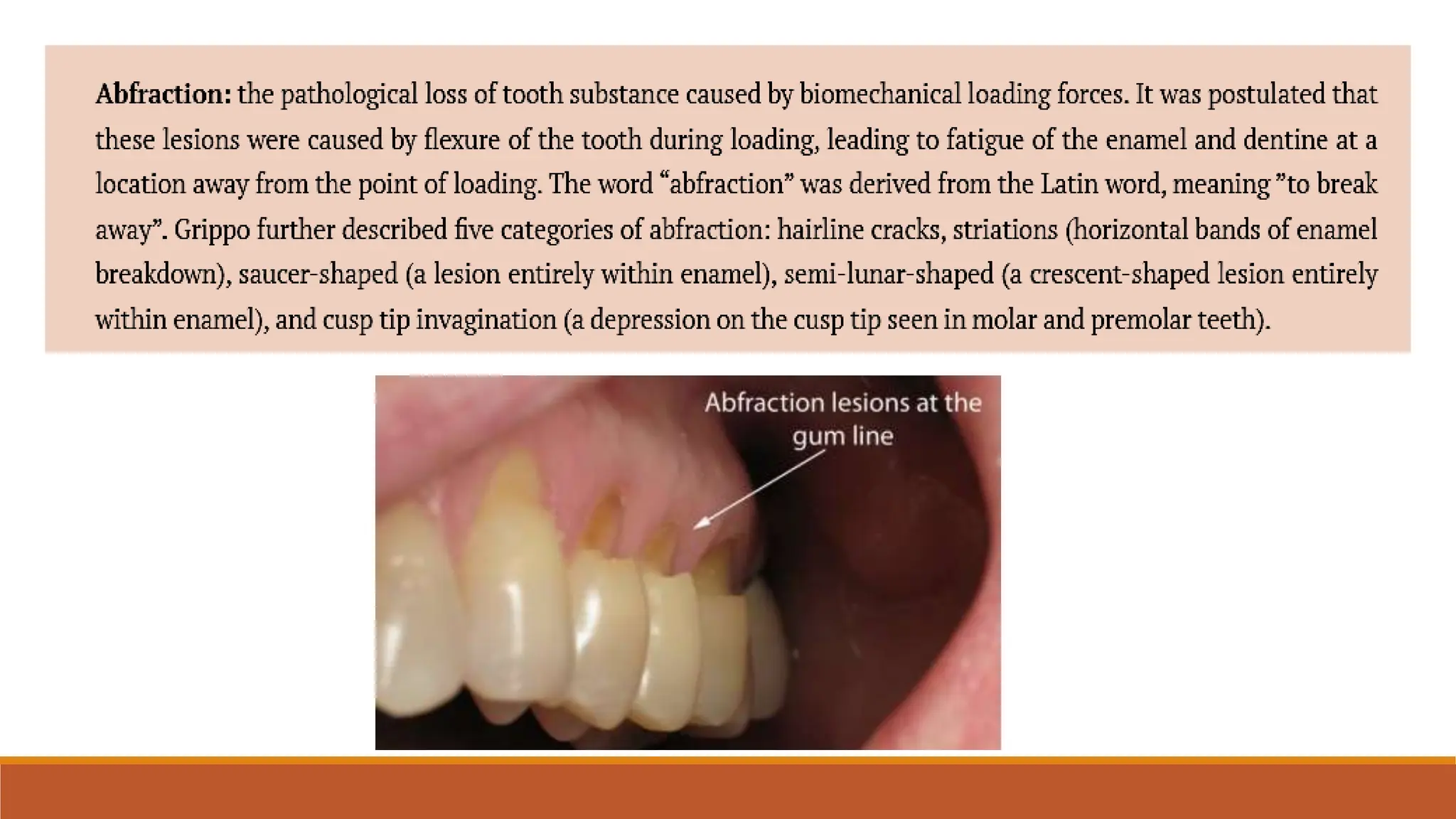intraoral and extraoral examination.pptx