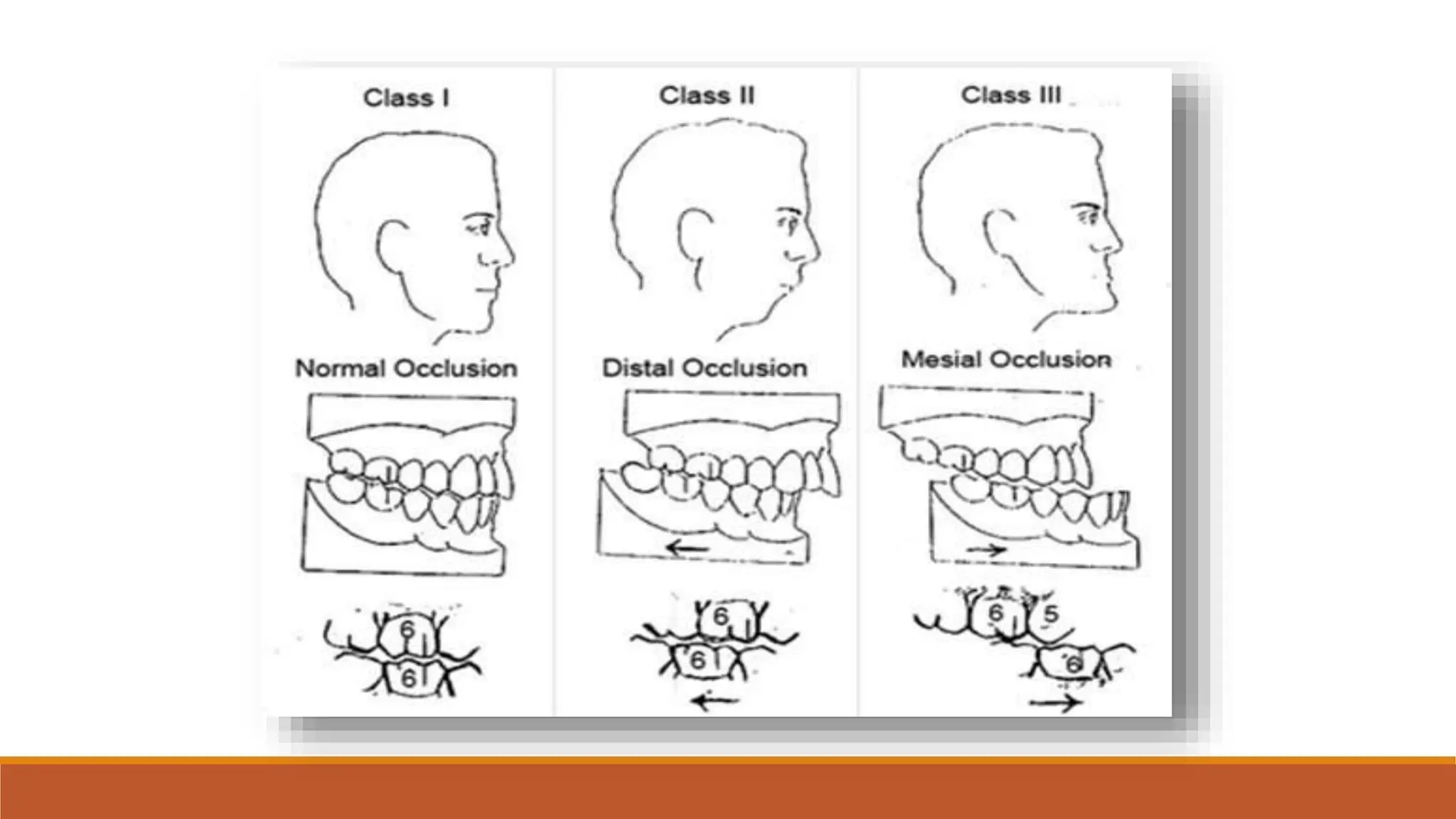 intraoral and extraoral examination.pptx