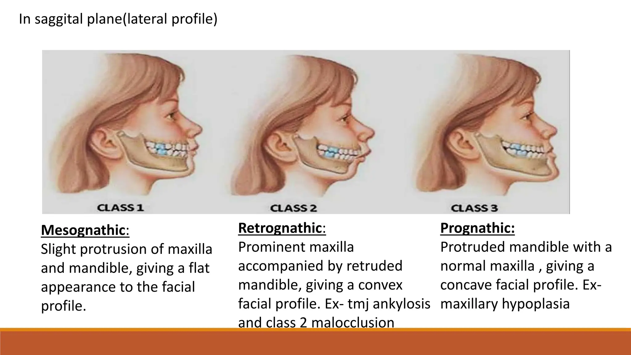 intraoral and extraoral examination.pptx