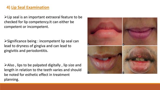 intraoral and extraoral examination.pptx