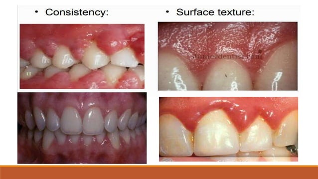 intraoral and extraoral examination.pptx
