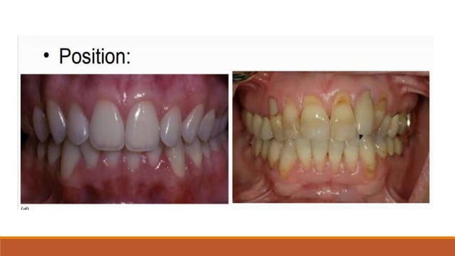 intraoral and extraoral examination.pptx