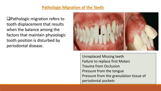 intraoral and extraoral examination.pptx
