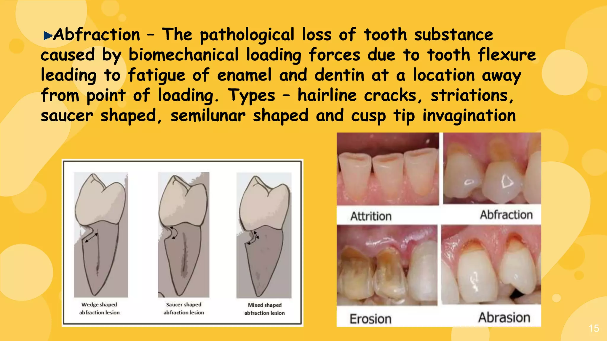 Periodontal Case History | PPTX