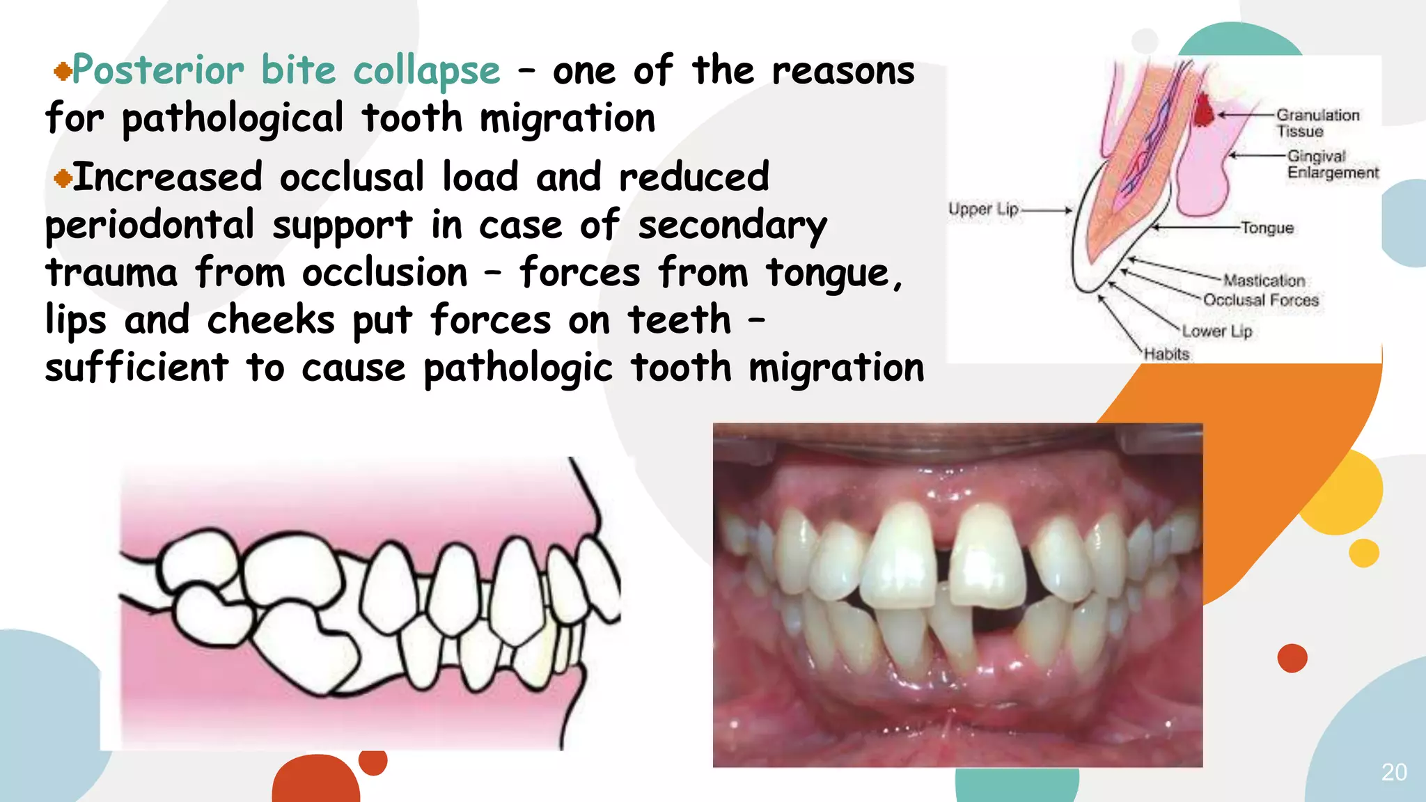 Periodontal Case History | PPT