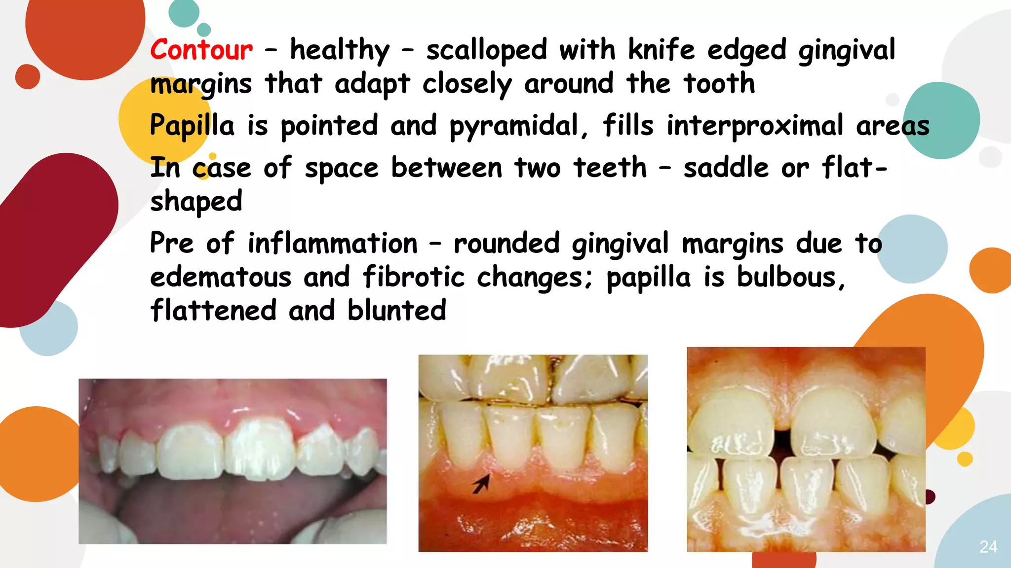 Periodontal Case History | PPTX