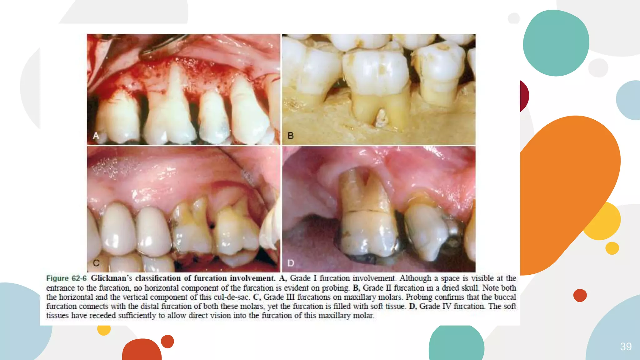 Periodontal Case History | PPTX