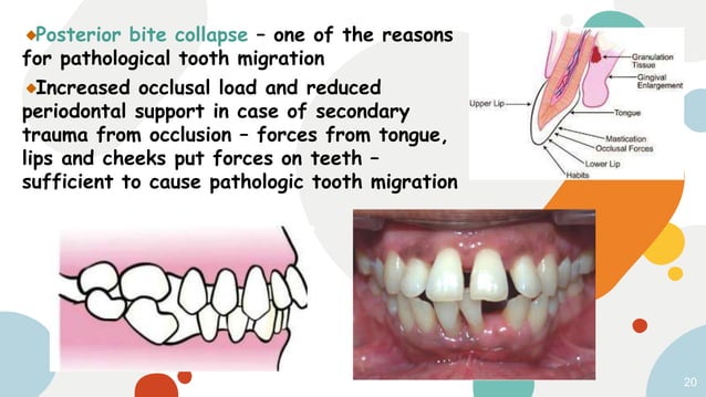 Periodontal Case History | PPTX | Dental Health | Diseases and Conditions
