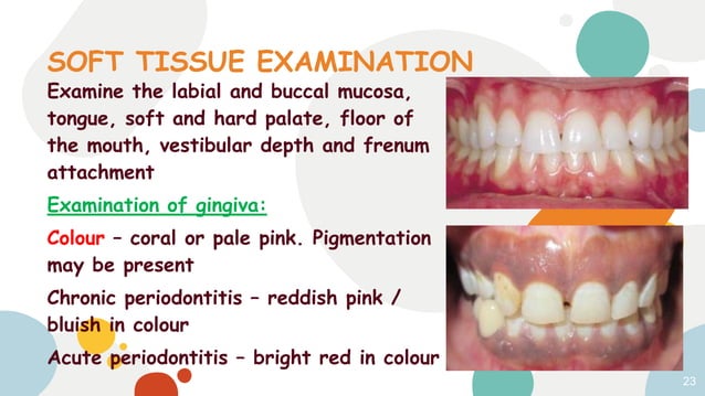 Periodontal Case History | PPTX | Dental Health | Diseases and Conditions