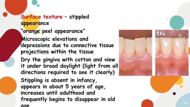 Periodontal Case History | PPTX | Dental Health | Diseases and Conditions