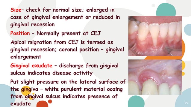 Periodontal Case History | PPTX | Dental Health | Diseases and Conditions