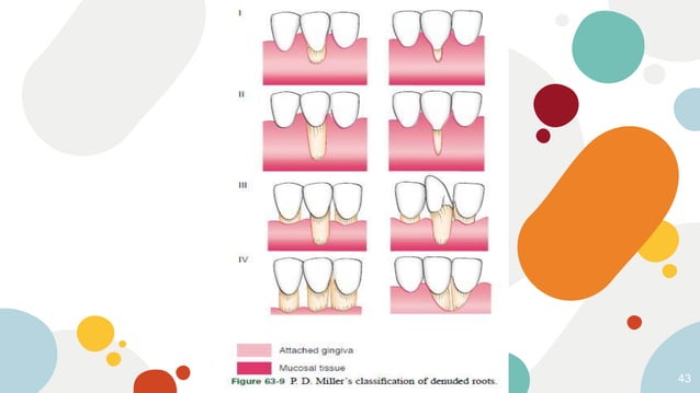 Periodontal Case History | PPTX | Dental Health | Diseases and Conditions