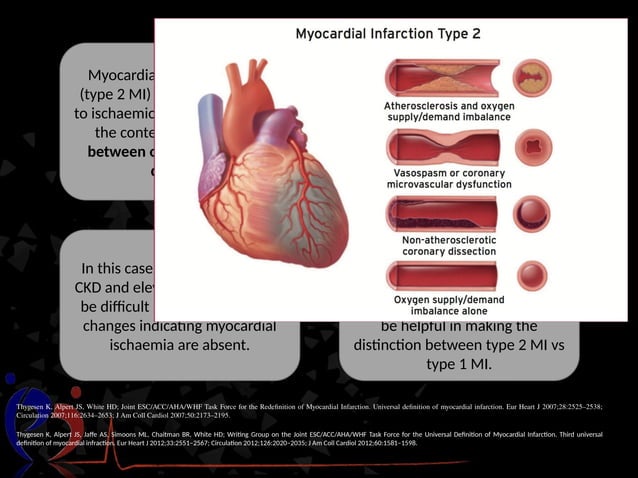 Case Myocardial Infarction Type two .pptx | Heart and Cardiovascular ...