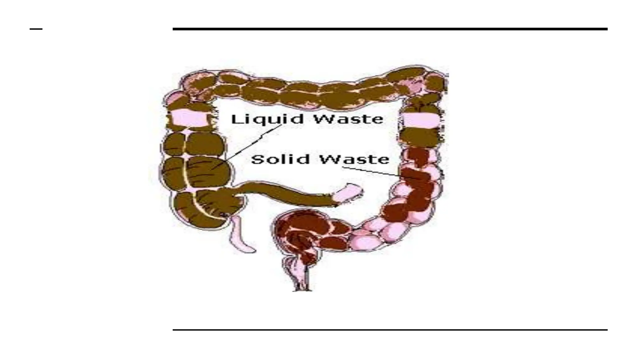Case in pediatric gastroenterology - constipation.pptx