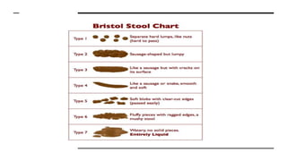 Case in pediatric gastroenterology - constipation.pptx