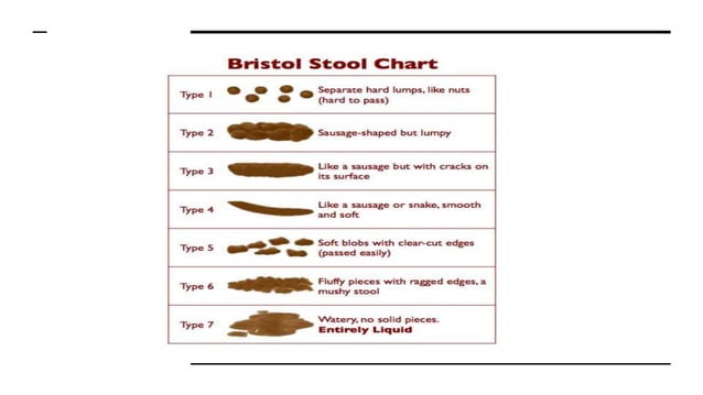 Case in pediatric gastroenterology - constipation.pptx