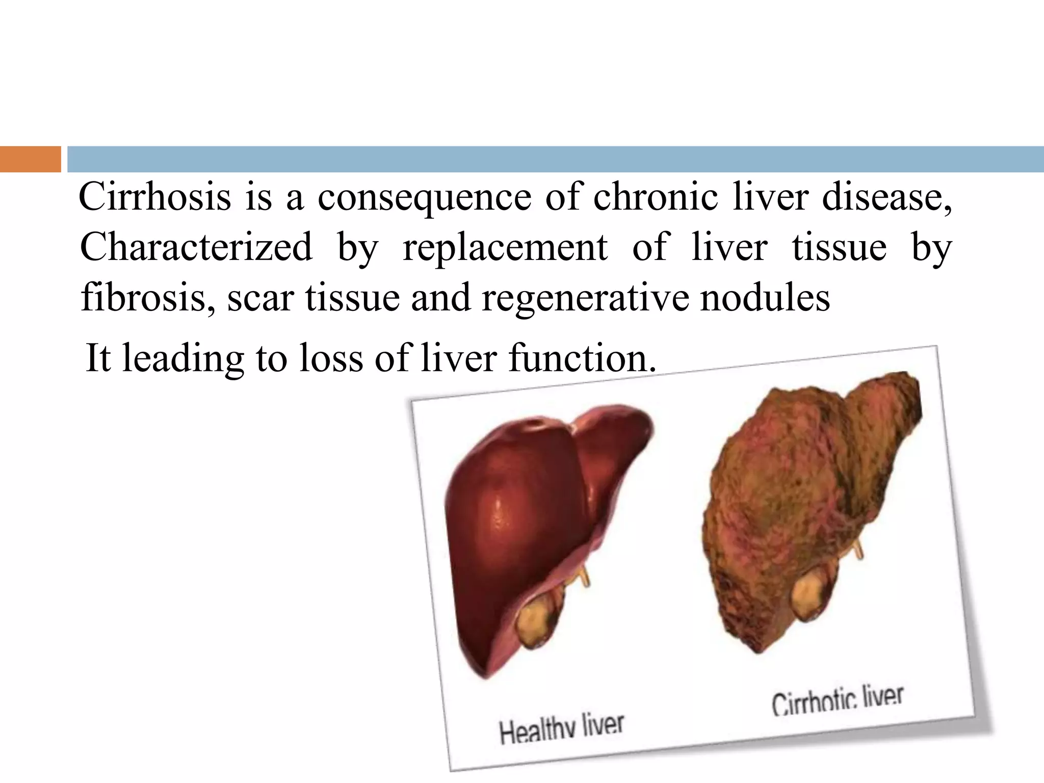 CASE PRESENTATION OF LIVER CIRRHOSIS PPT by MADHUKAR THAGNAR | PPTX