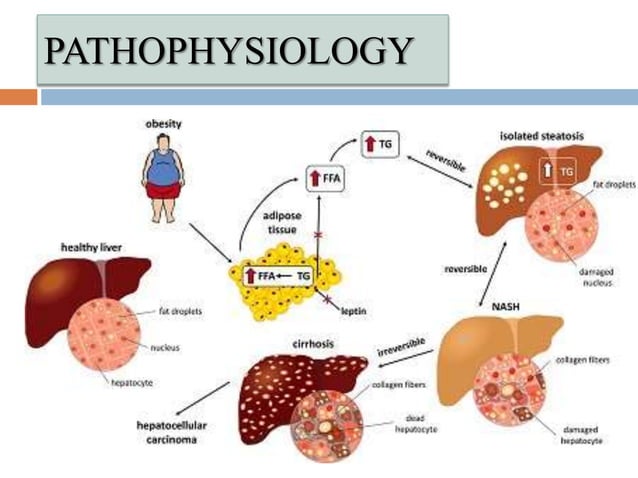 CASE PRESENTATION OF LIVER CIRRHOSIS PPT by MADHUKAR THAGNAR | PPTX