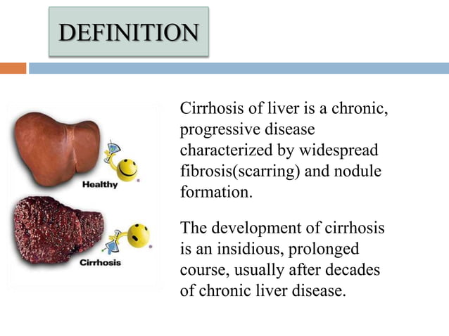 CASE PRESENTATION OF LIVER CIRRHOSIS PPT by MADHUKAR THAGNAR | PPTX