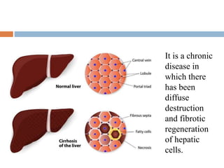 CASE PRESENTATION OF LIVER CIRRHOSIS PPT by MADHUKAR THAGNAR | PPTX