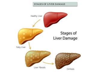 CASE PRESENTATION OF LIVER CIRRHOSIS PPT by MADHUKAR THAGNAR | PPTX