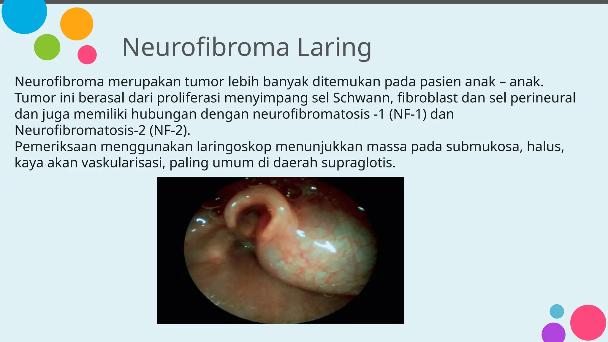 LAPORAN KASUS massa laring THT fix1.pptx