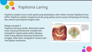 LAPORAN KASUS massa laring THT fix1.pptx