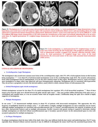 Case record...Parasagittal meningioma | PDF