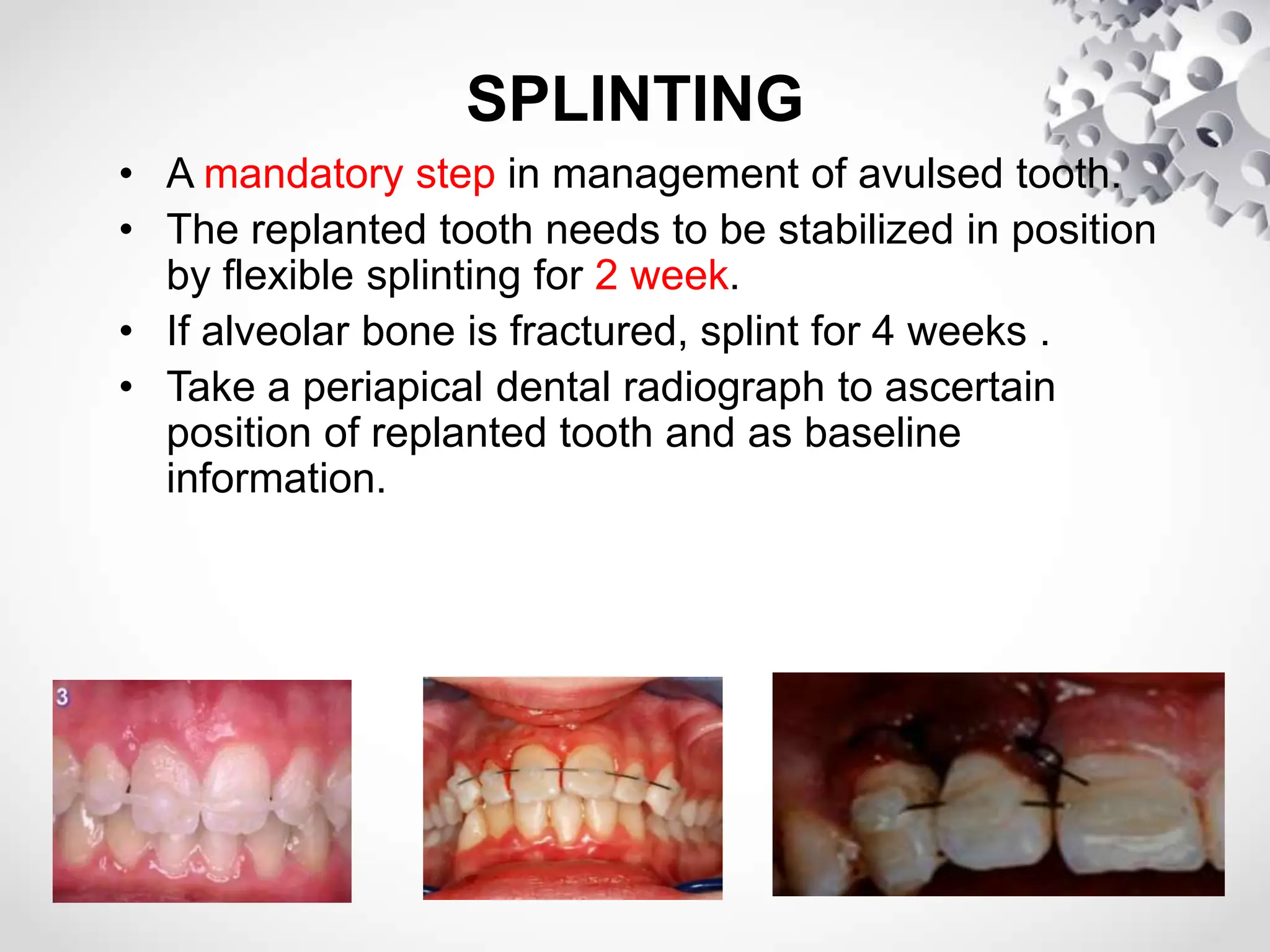 Case of avulsion in Permanent dentition.pptx | Dental Health | Diseases ...