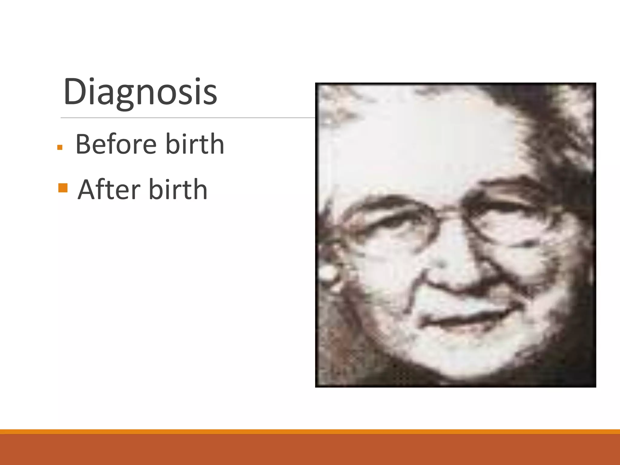 Case of birth asphyxia | PPTX
