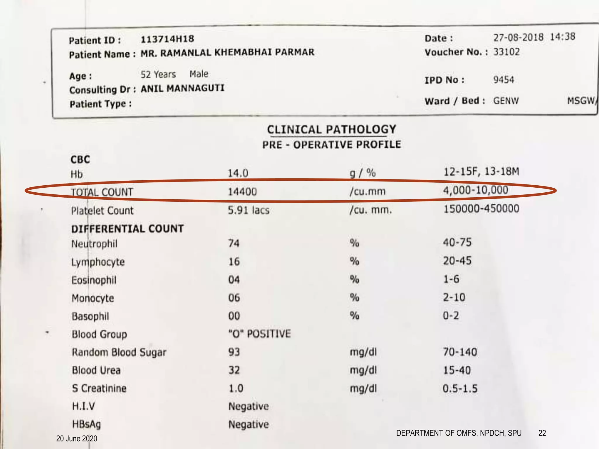 Case of epidermoid cyst in mandible a rare entity and review. | PPTX
