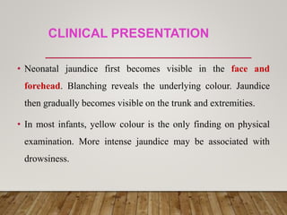 Neonatal jaundice ppt | PPTX
