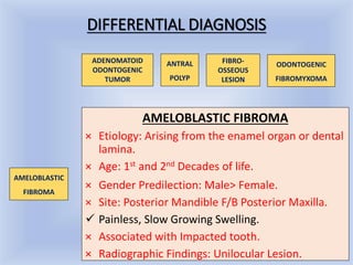 Case of odontogeic fibromyxoma of maxilla case report: a rare entity ...