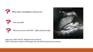 Case of Polytrauma. Case of Polytrauma and approach | PPTX