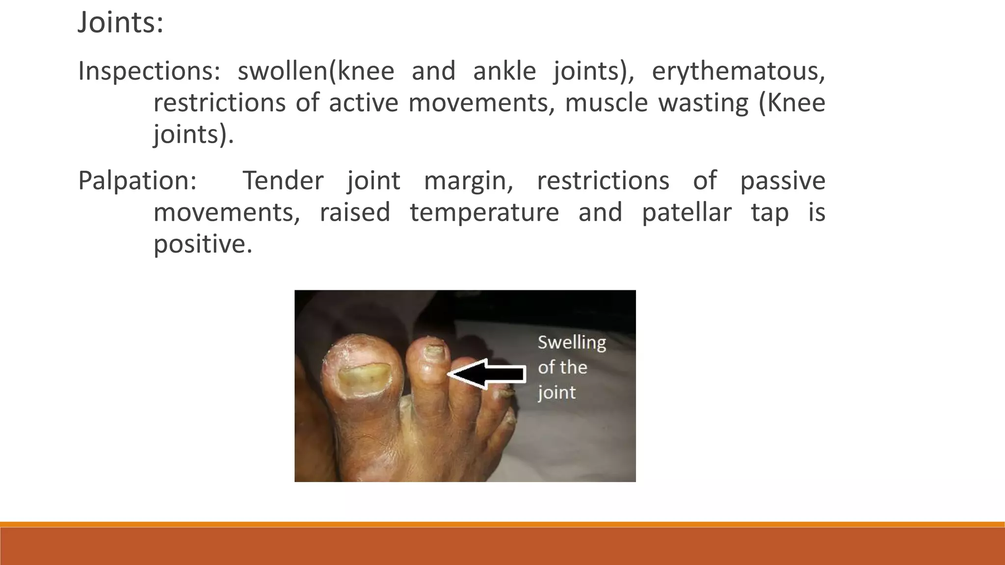Case of psoriatic arthritis | PPTX