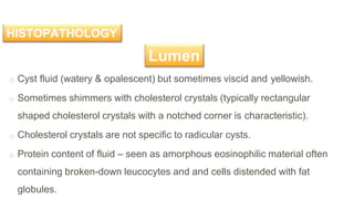 Case of Radicular Cyst | PPTX