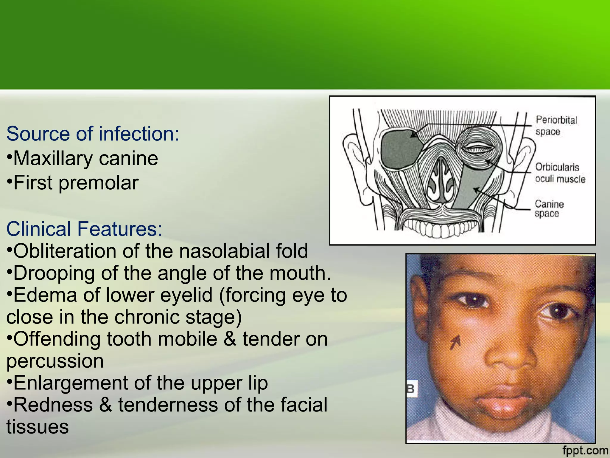 Case of space infection | PPT