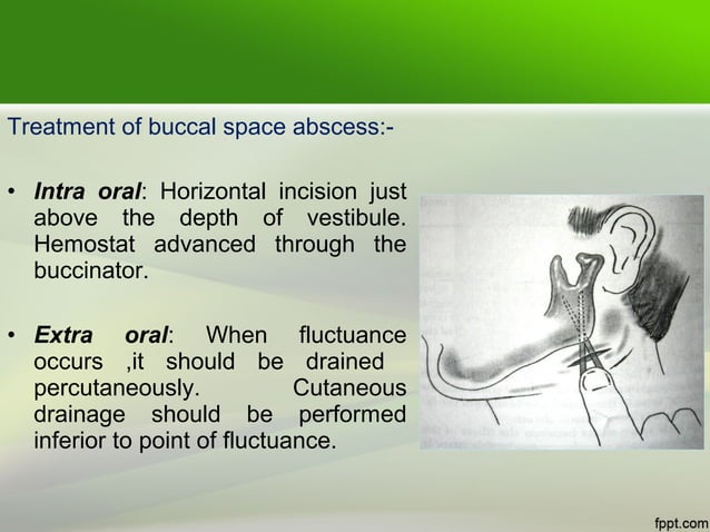 Case of space infection | PPT | Ear, Nose and Throat Conditions ...