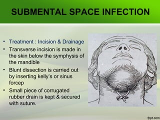 Case of space infection | PPT