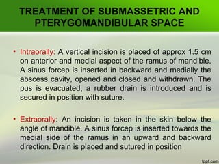 Pterygomandibular Space Infection