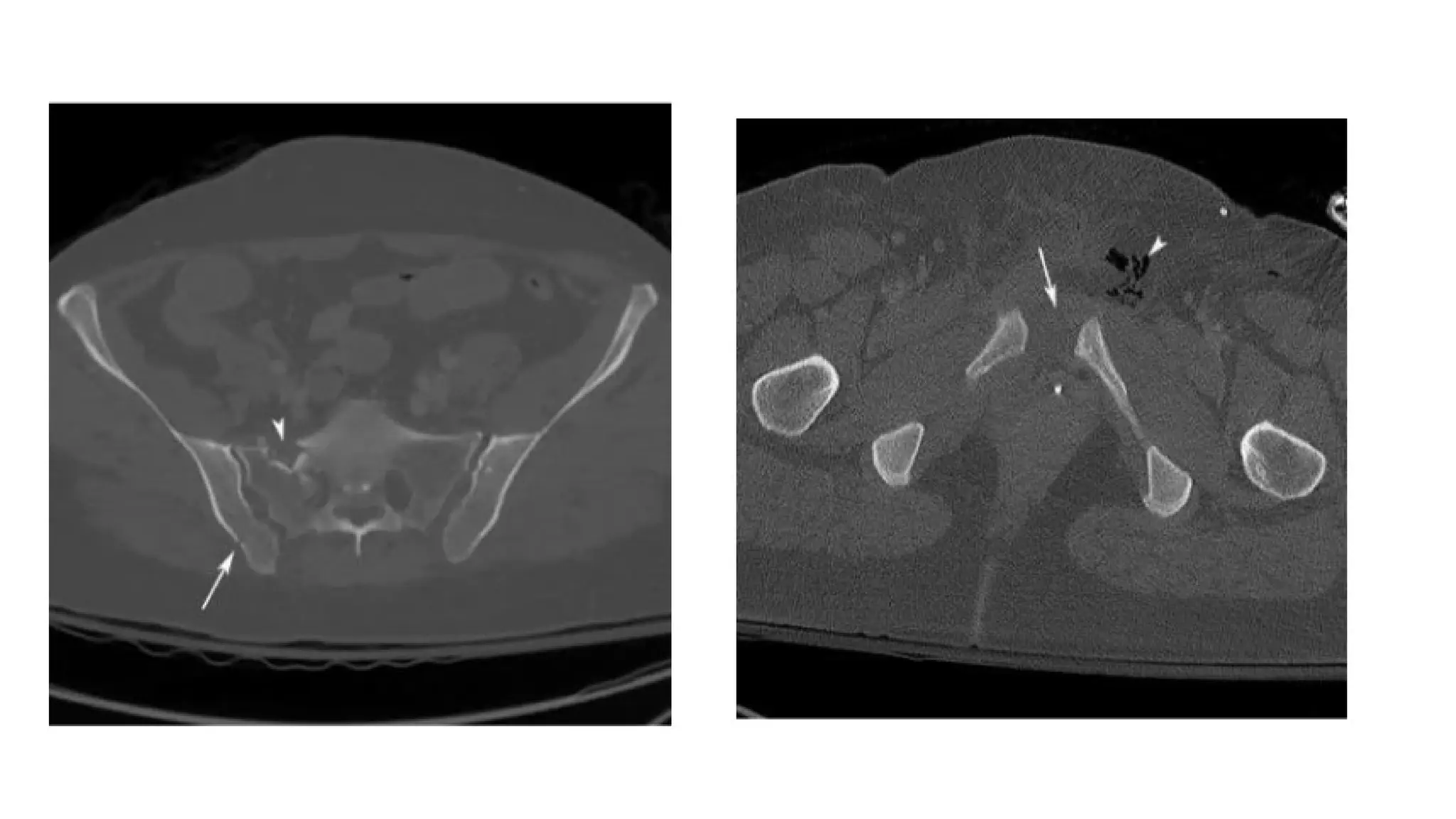 Case of the week RTA patient with multiple fracture | PPTX