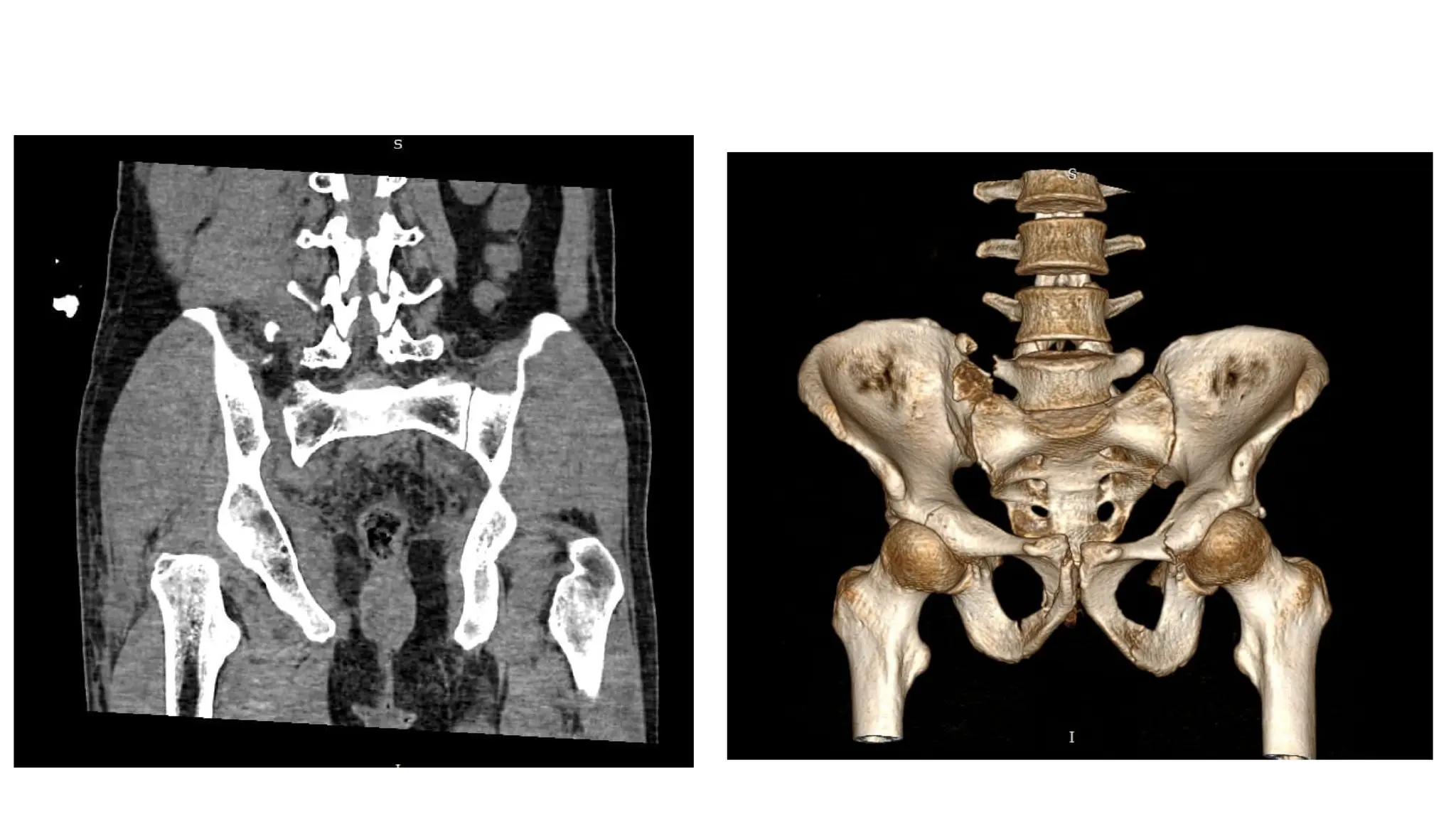 Case of the week RTA patient with multiple fracture | PPTX