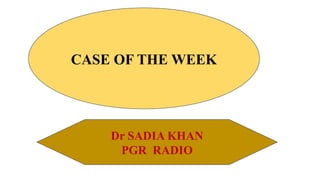 Case of the week RTA patient with multiple fracture | PPTX