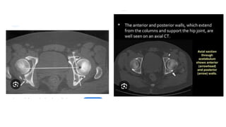 Case of the week RTA patient with multiple fracture | PPTX