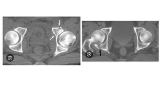 Case of the week RTA patient with multiple fracture | PPTX