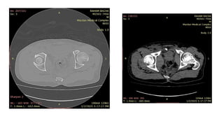 Case of the week RTA patient with multiple fracture | PPTX