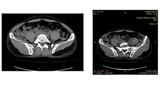 Case of the week RTA patient with multiple fracture | PPTX