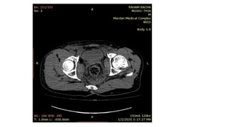 Case of the week RTA patient with multiple fracture | PPTX