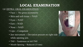 Case of TMJ Subluxation | PPTX